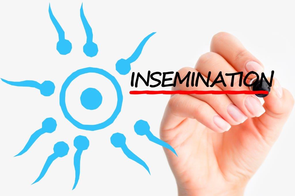 What is Intrauterine Insemination (IUI)? - ARC Fertility