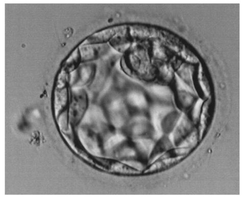 Blastocyst - ARC Fertility