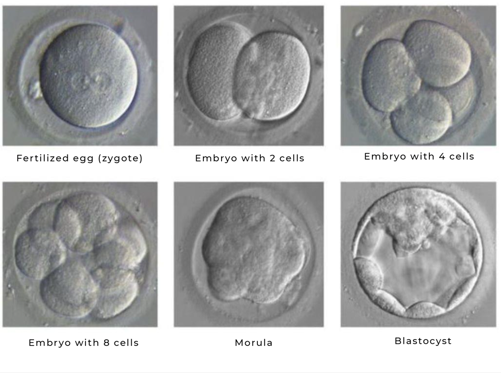 Understanding IVF Embryo Grading Systems ARC Fertility